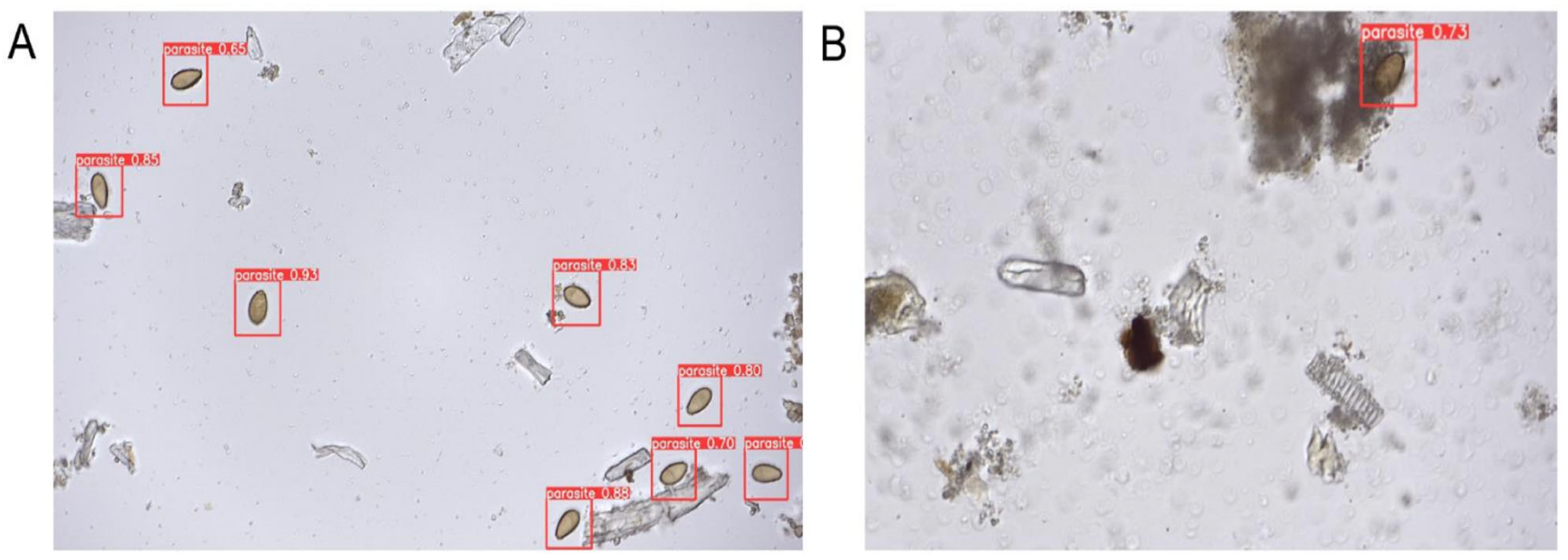 Artificial Intelligence-Based Detection of Clonorchis sinensis and ...