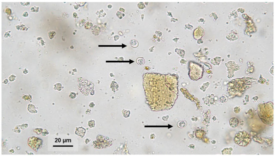 PCR Detection, Genotyping, and Differentiation of Toxoplasma gondii ...