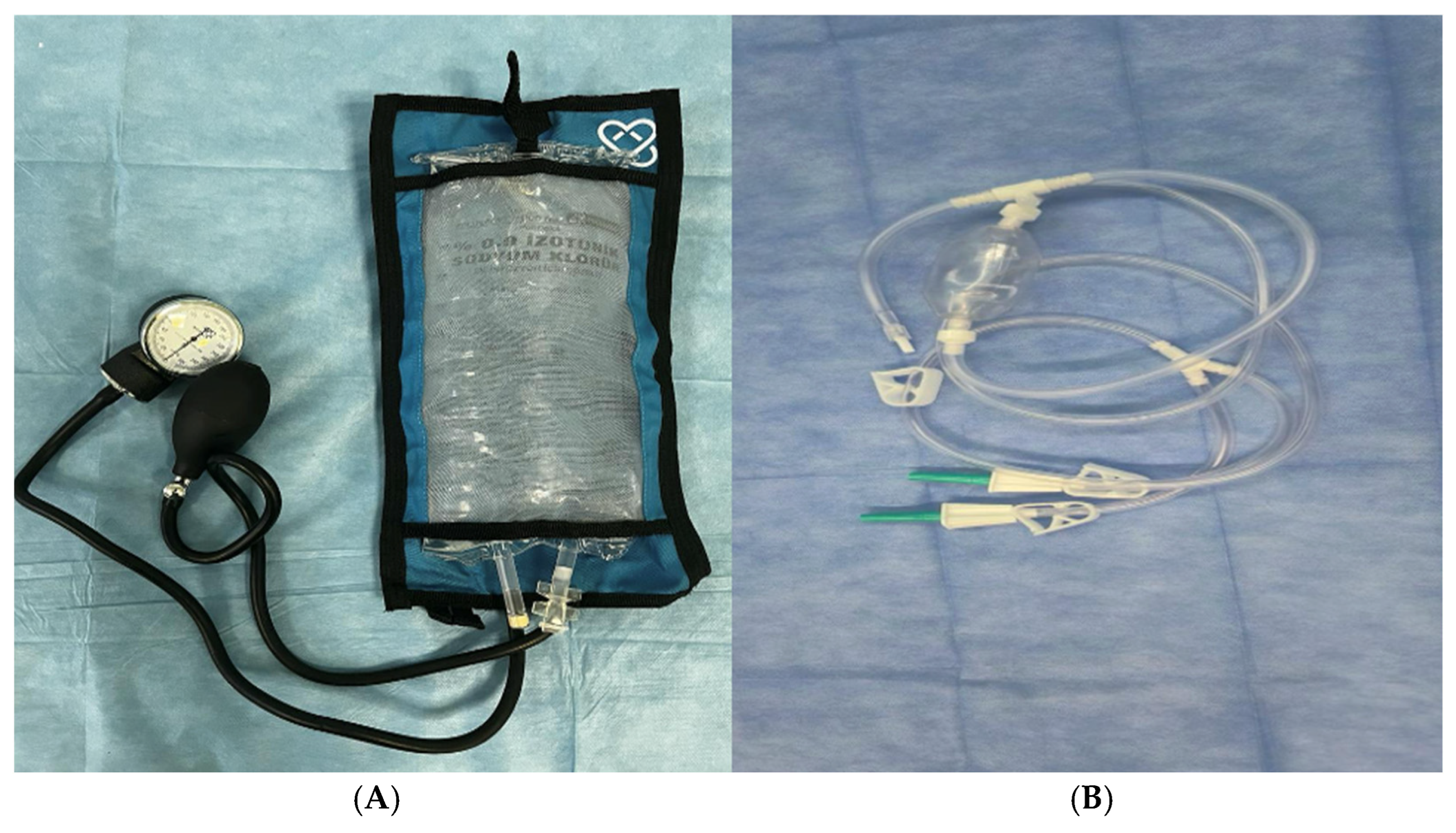 Urinary Tract Infectious Complications After Retrograde Intrarenal ...