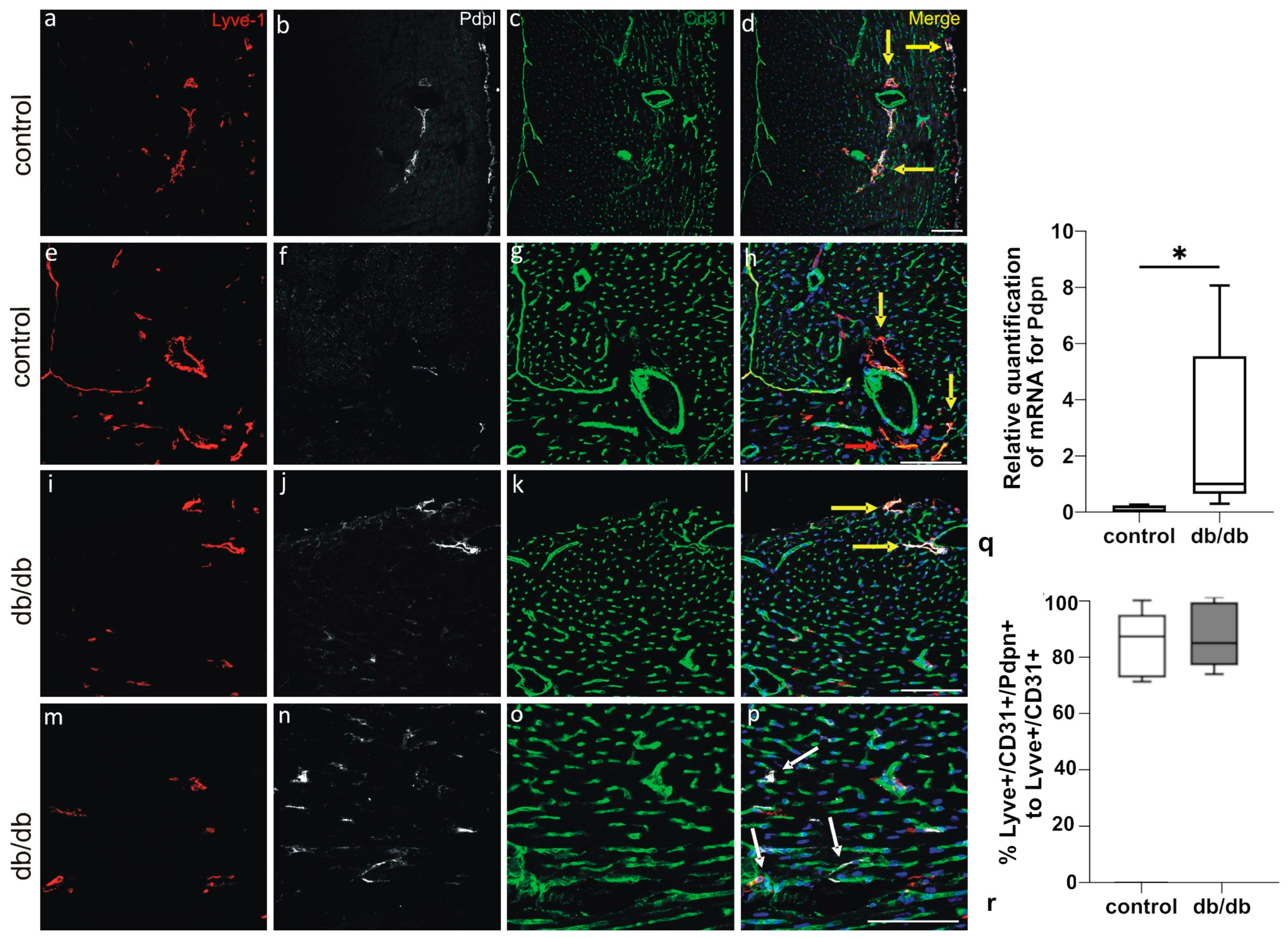 Metabolic Syndrome-Driven Changes in Cardiac Lymphatic Endothelium ...