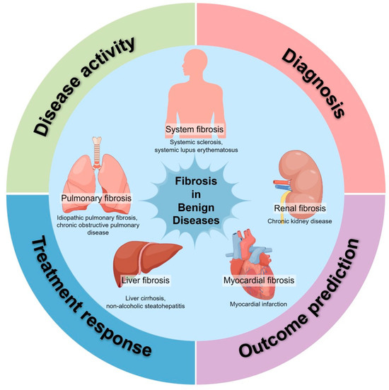 Pharmaceuticals | Free Full-Text | Molecular Imaging of Fibrosis in ...