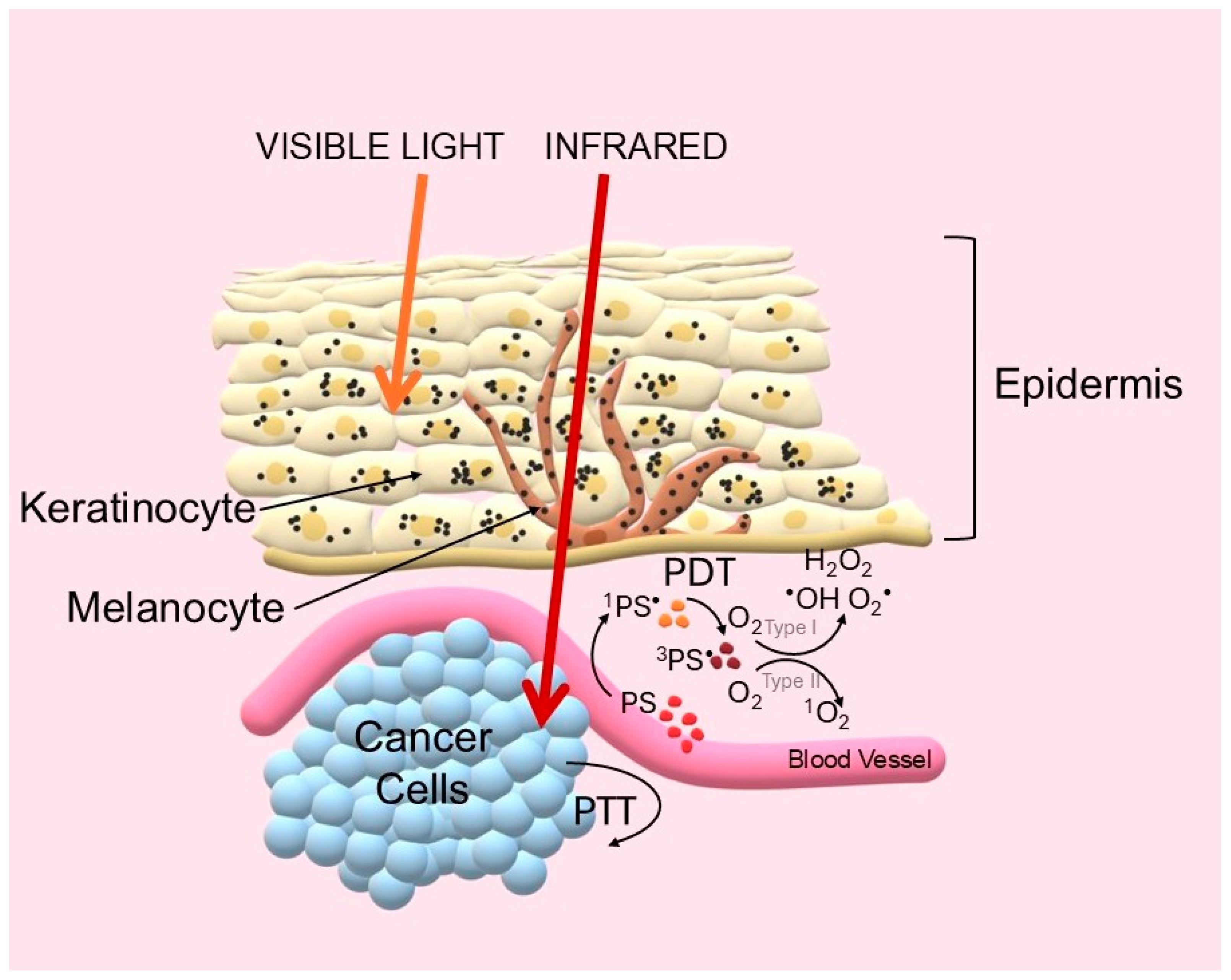 Advances in Near-Infrared BODIPY Photosensitizers: Design Strategies ...