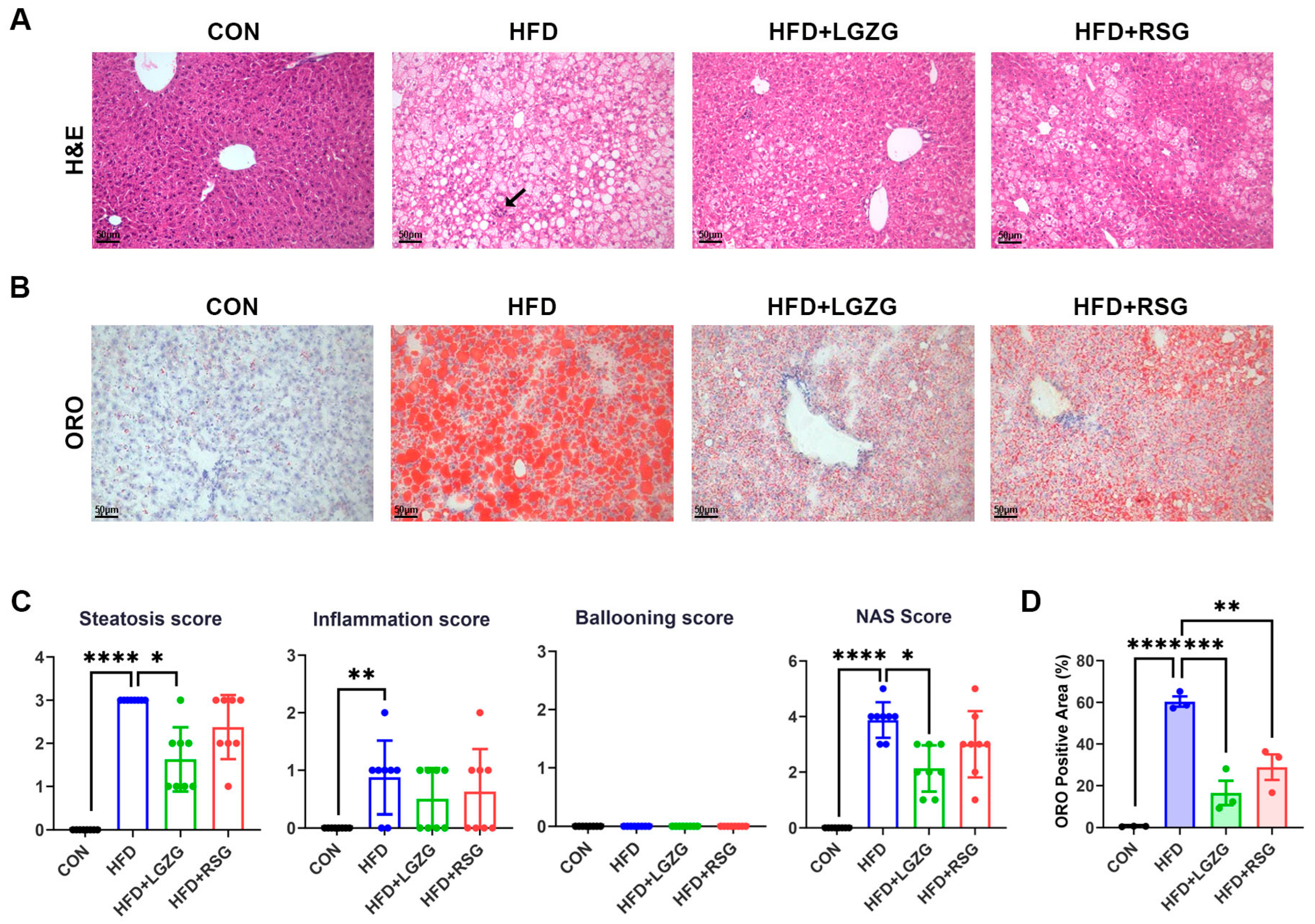 Lingguizhugan Decoction Ameliorates MASLD by Modulating the Gut ...