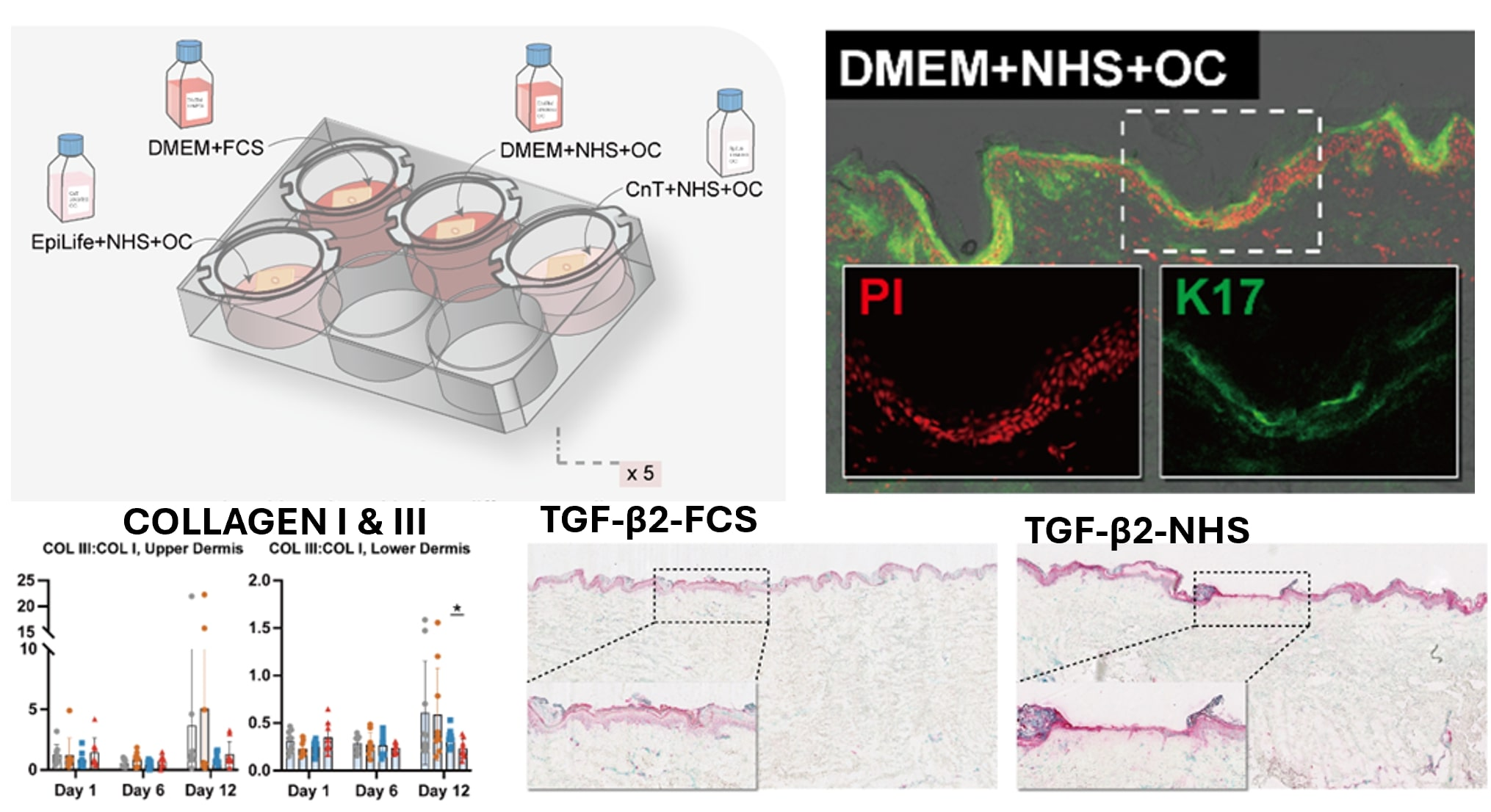Improving the Culture of Human Skin Explants for Use in Preclinical ...