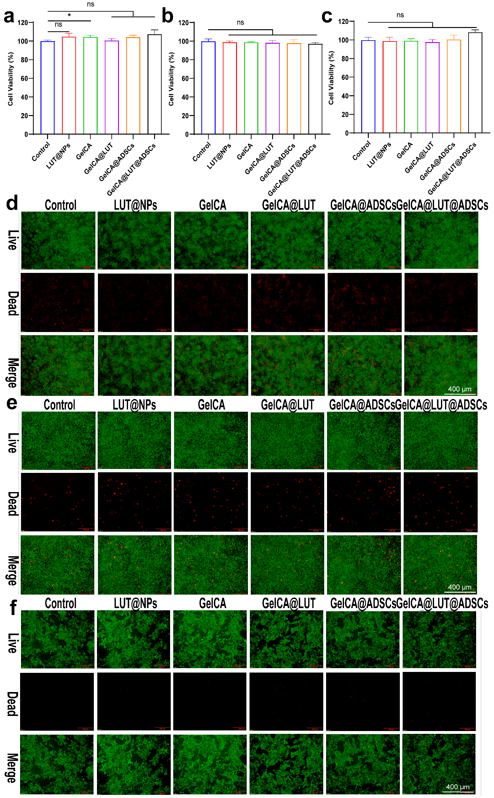 A Multifunctional Hydrogel Incorporating Luteolin-Encapsulated ROS ...