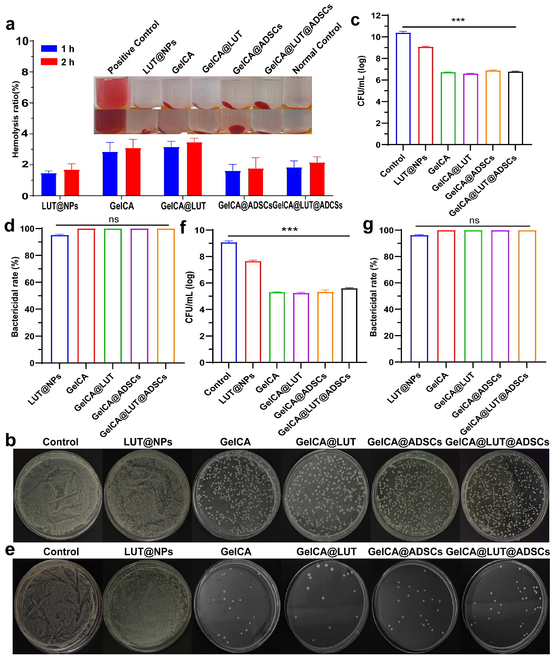 A Multifunctional Hydrogel Incorporating Luteolin-Encapsulated ROS ...