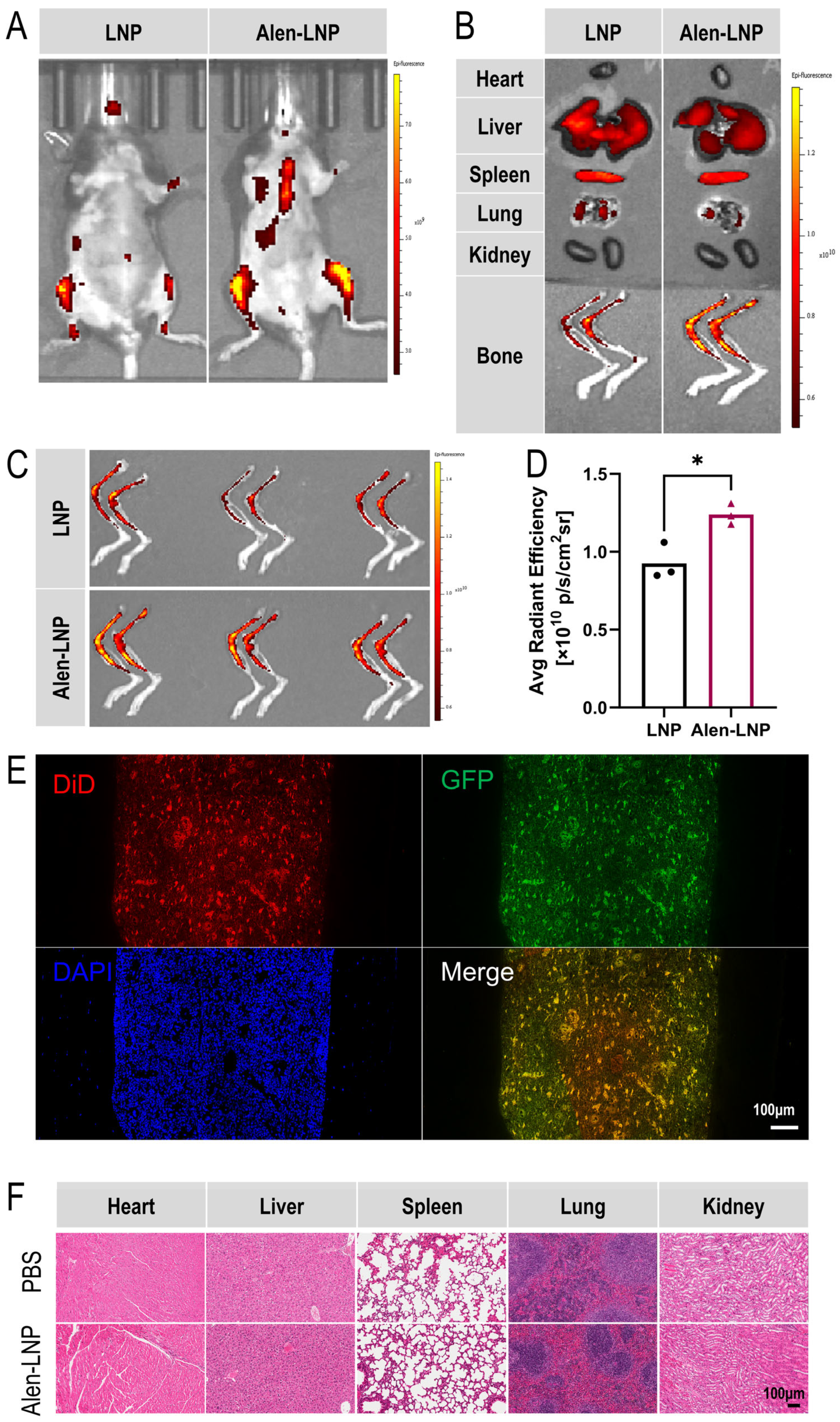 Microfluidic Fabrication of Alendronate-Modified Lipid Nanoparticles ...