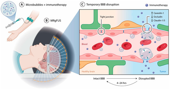 Ultrasound-Enhanced Drug Delivery in Pediatric Neuro-Oncology: A New ...