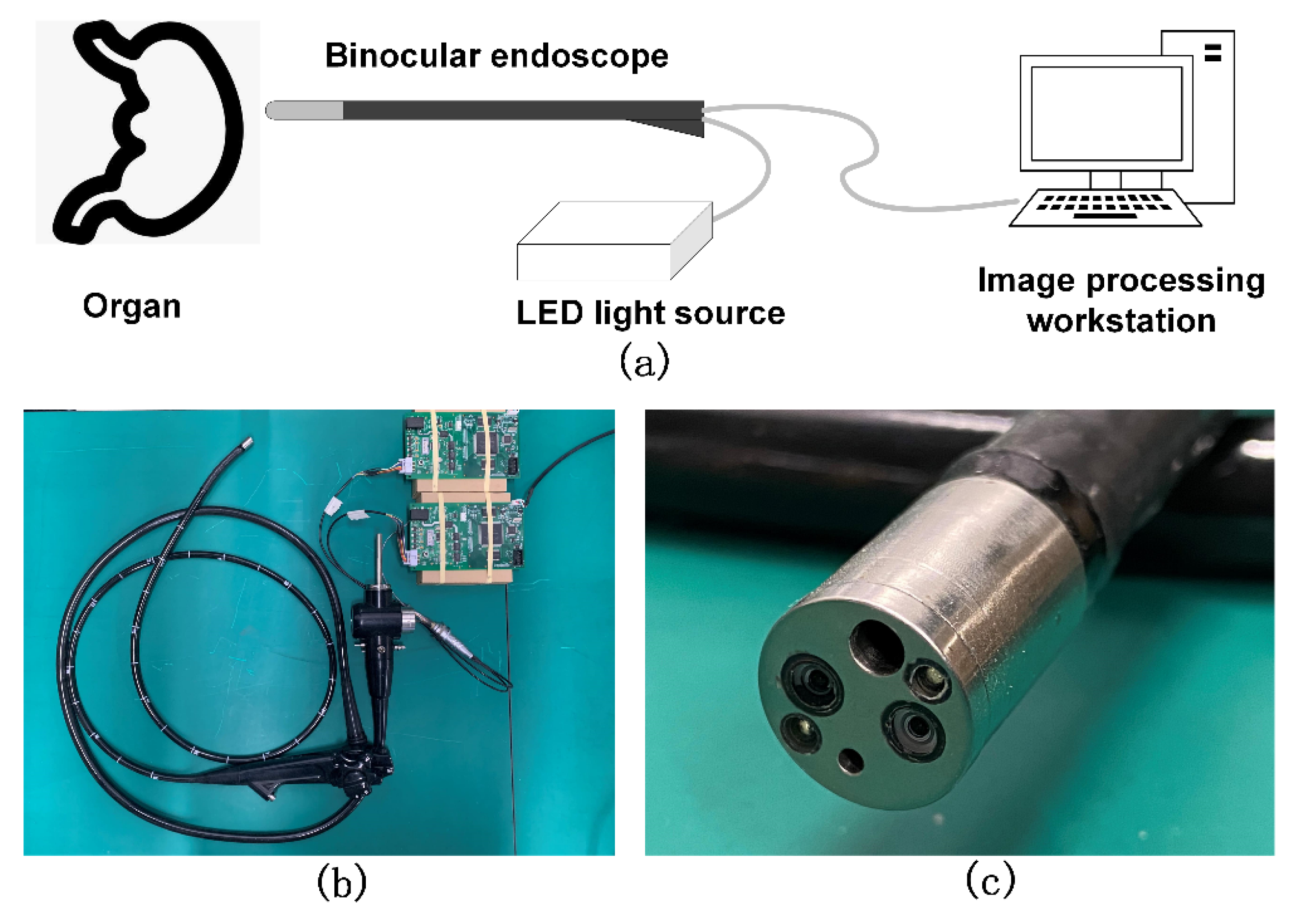 Three-Dimensional Stitching of Binocular Endoscopic Images Based on ...