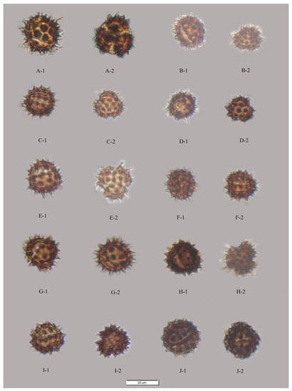 Comparative Pollen Morphology of Selected Species of Blumea DC. and ...