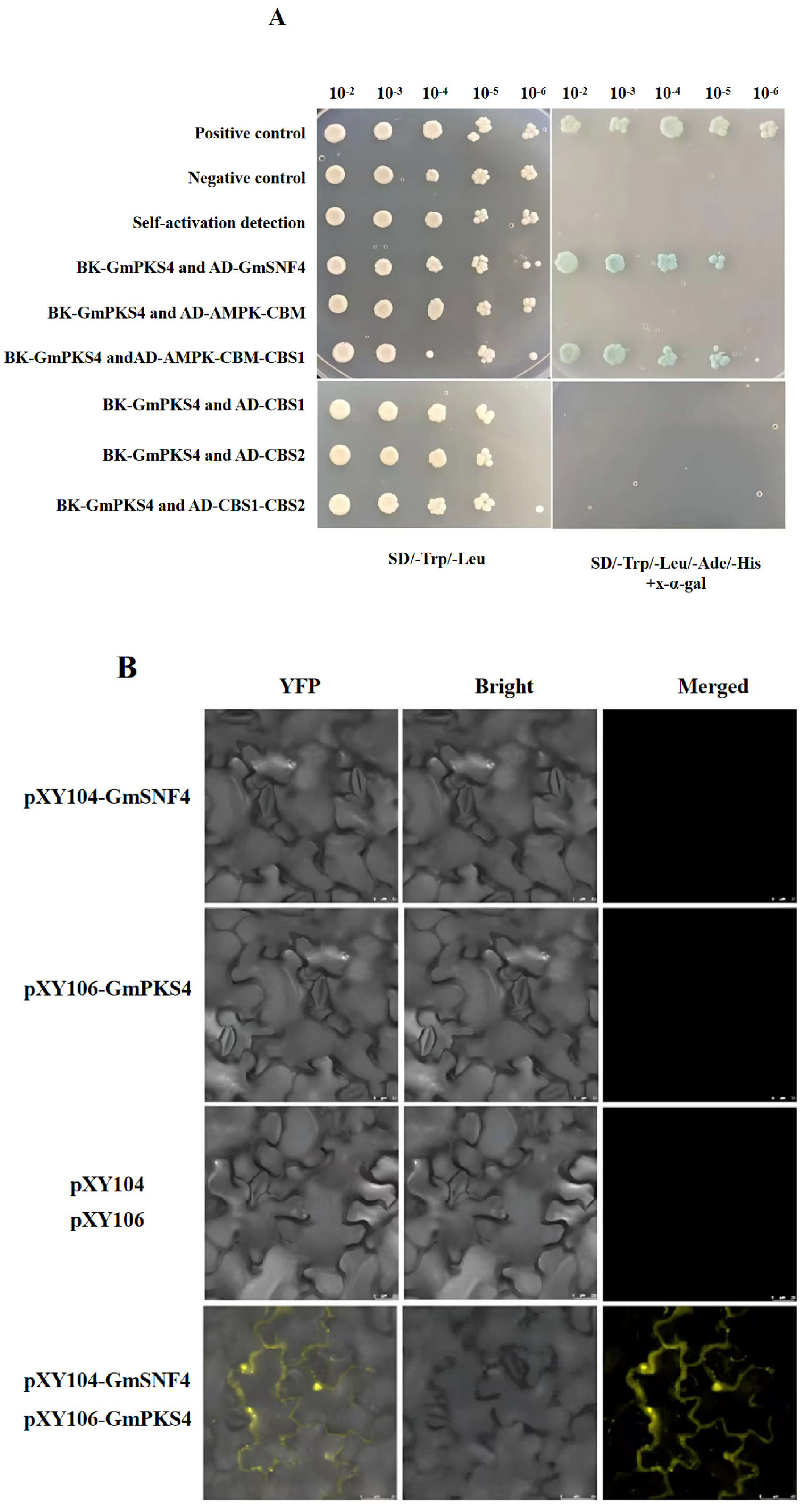 Soybean GmSNF4 Confers Salt–Alkali Stress Tolerance in Transgenic Plants
