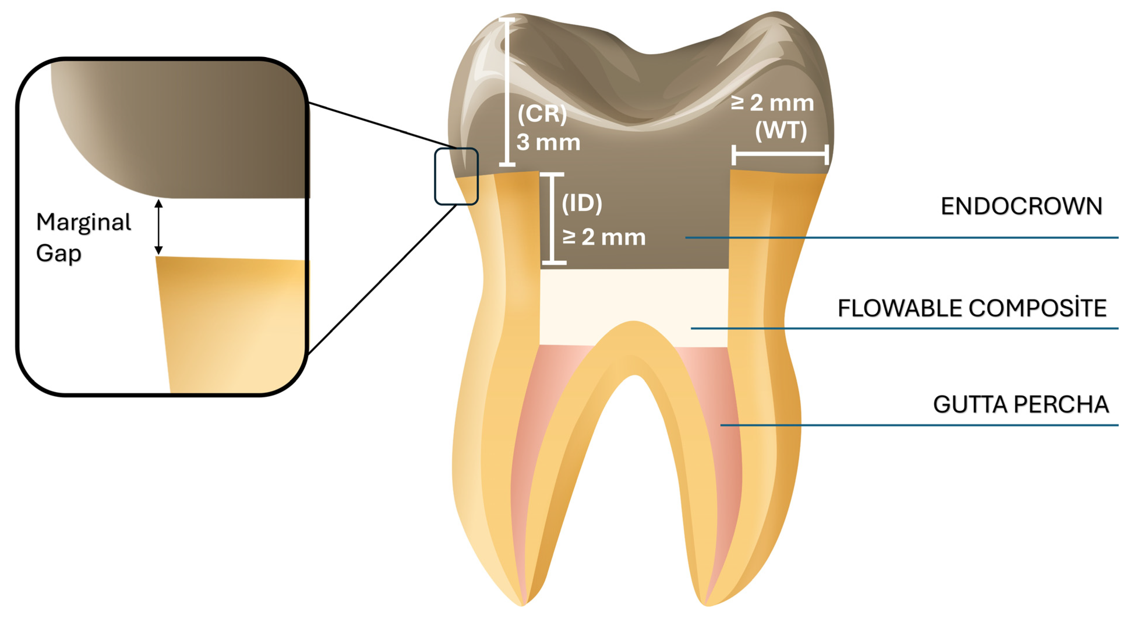 Impact of Thermomechanical Aging on Marginal Fit and Fracture ...