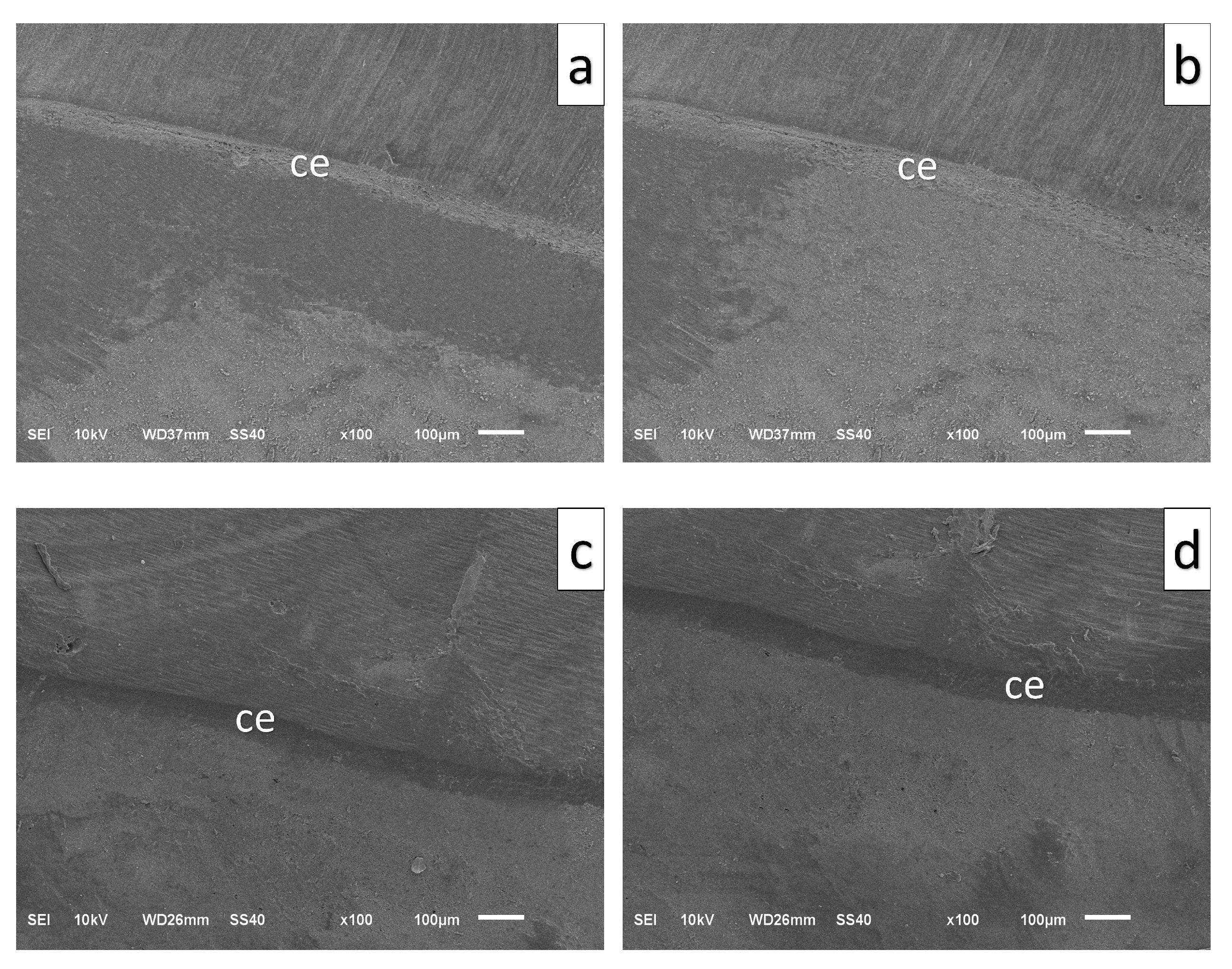 Effect of Tooth Preparation Design on Fracture Resistance and Marginal ...