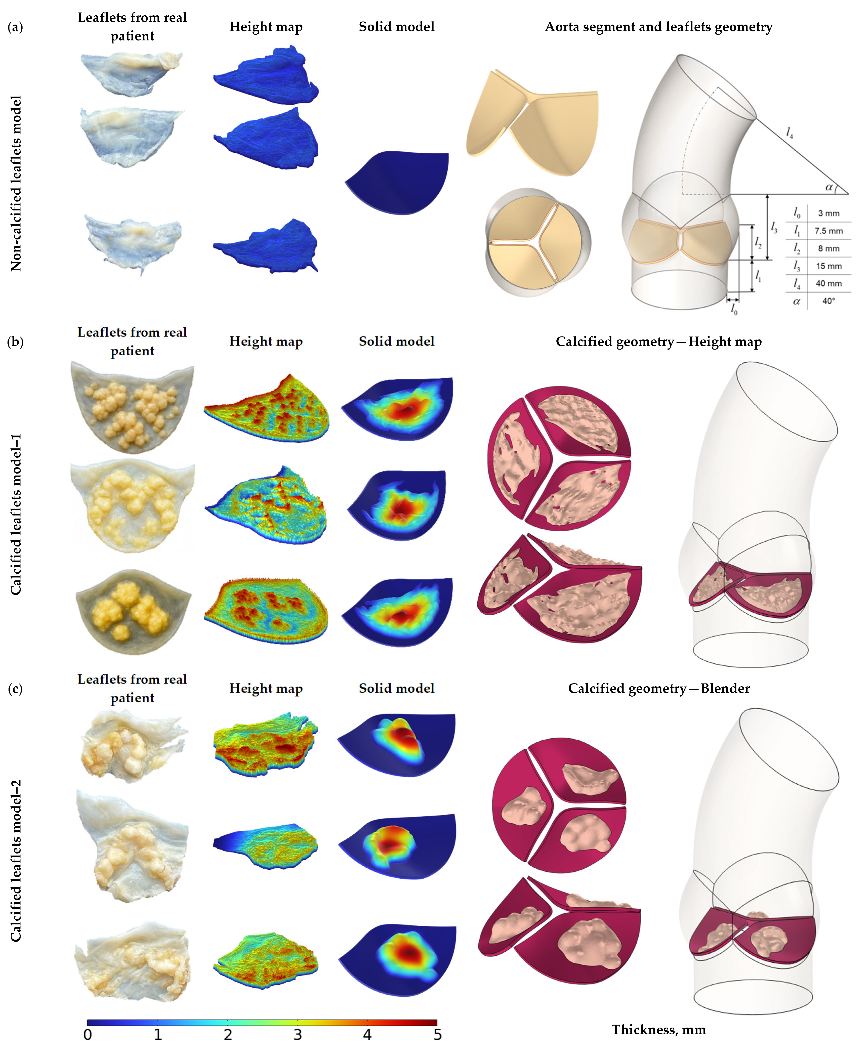 Numerical Simulation of Aortic Valve Leaflets Calcification Influence ...
