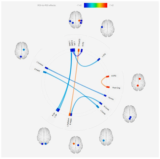 Effect of a One-Week Spiritual Retreat on Brain Functional Connectivity ...