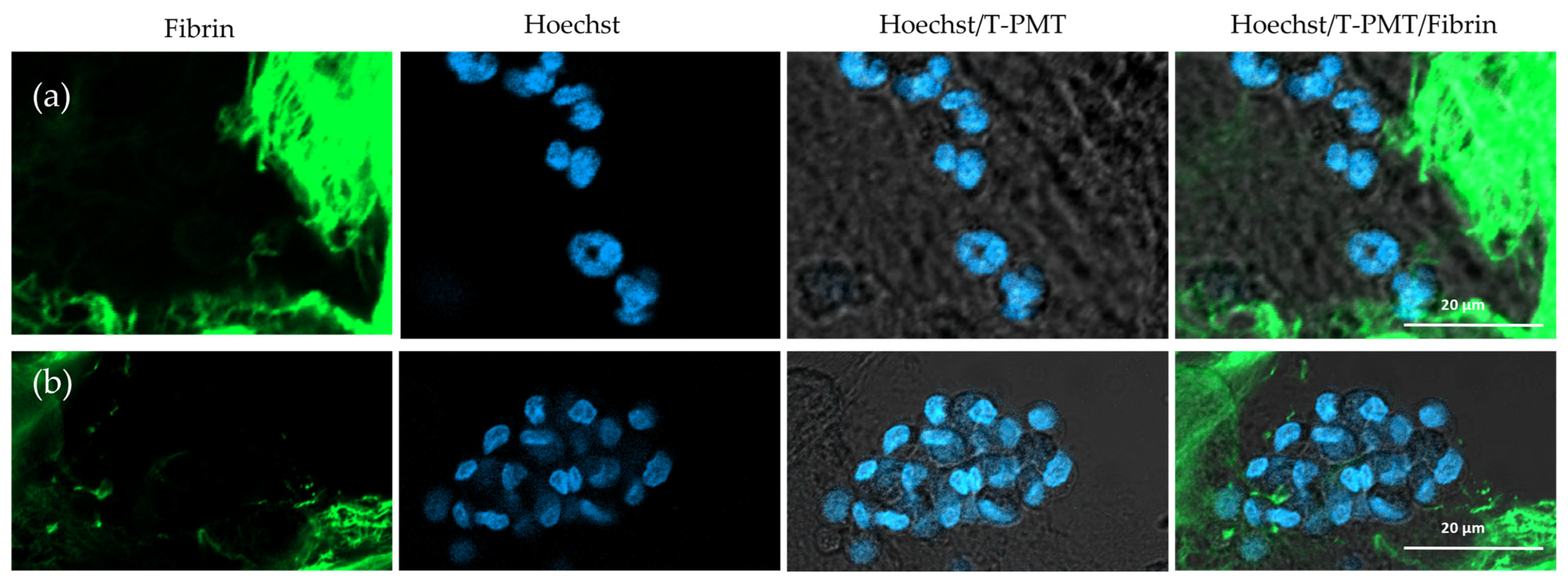 Morphological and Molecular Characterization of Menstrual Blood ...
