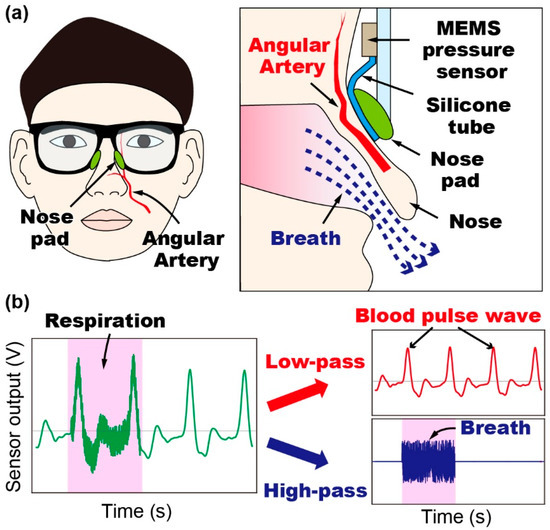 MEMS-Based Sensor for Simultaneous Measurement of Pulse Wave and ...
