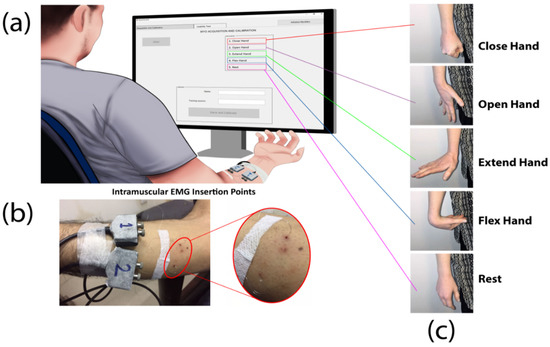 A Multiday Evaluation of Real-Time Intramuscular EMG Usability with ANN