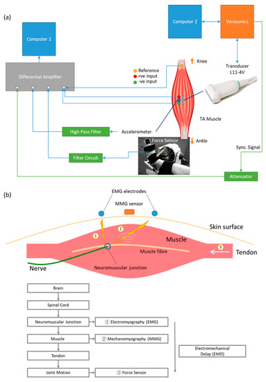 Sonomechanomyography (SMMG): Mapping of Skeletal Muscle Motion Onset ...