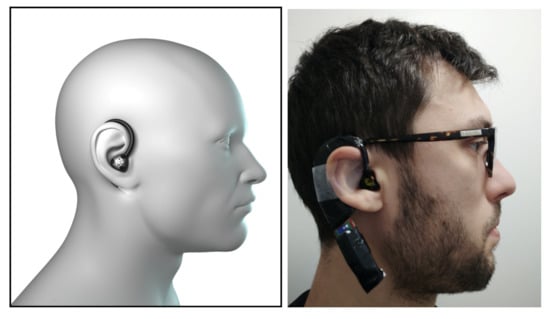 Man Down Situation Detection Using an in-Ear Inertial Platform