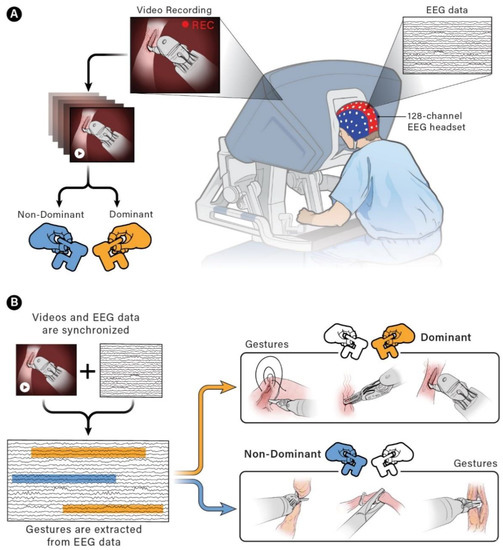Surgical Hand Gesture Recognition Utilizing Electroencephalogram as ...