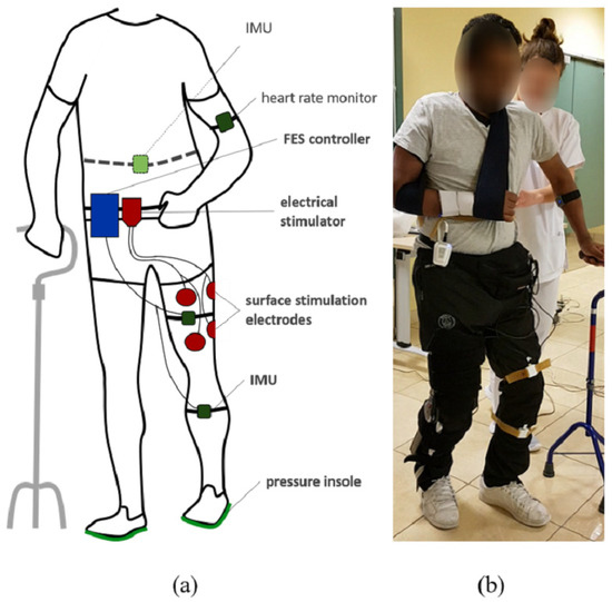 A Sensor-Based Multichannel FES System to Control Knee Joint and Reduce ...