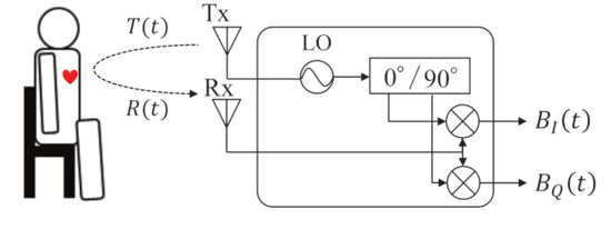 High Accuracy Heartbeat Detection from CW-Doppler Radar Using Singular ...