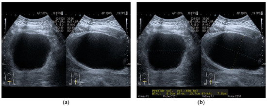 Novel Three-Dimensional Bladder Reconstruction Model from B-Mode ...