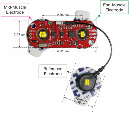 Electromyogram-Based Classification of Hand and Finger Gestures Using ...