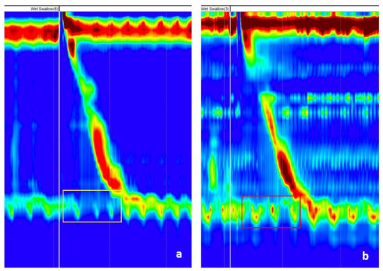 Sensors | Free Full-Text | Integrated Relaxation Pressure ...