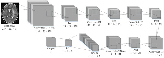 Sensors | Free Full-Text | Brain Tumor/Mass Classification Framework ...