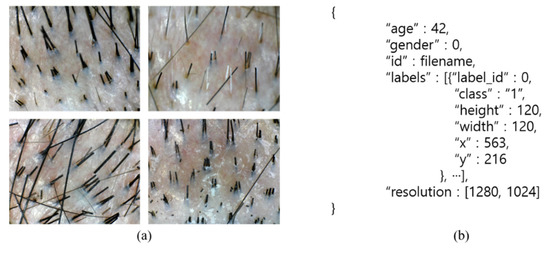 Evaluation of Automated Measurement of Hair Density Using Deep Neural ...
