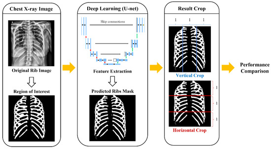 Segmentation Performance Comparison Considering Regional ...