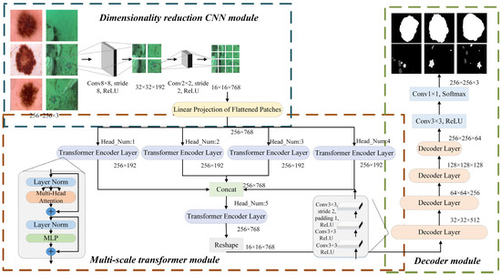 Sensors | Free Full-Text | MulTNet: A Multi-Scale Transformer Network ...