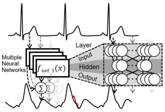 GRU Neural Network Improved Bioimpedance Based Stroke Volume Estimation ...