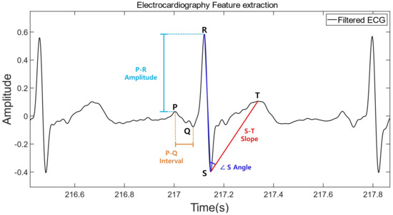 Intelligent Feature Selection for ECG-Based Personal Authentication ...