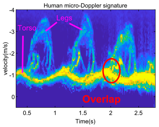Extraction of Human Limbs Based on Micro-Doppler-Range Trajectories ...