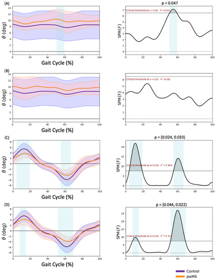 Kinematic Gait Analysis in People with Mild-Disability Multiple ...
