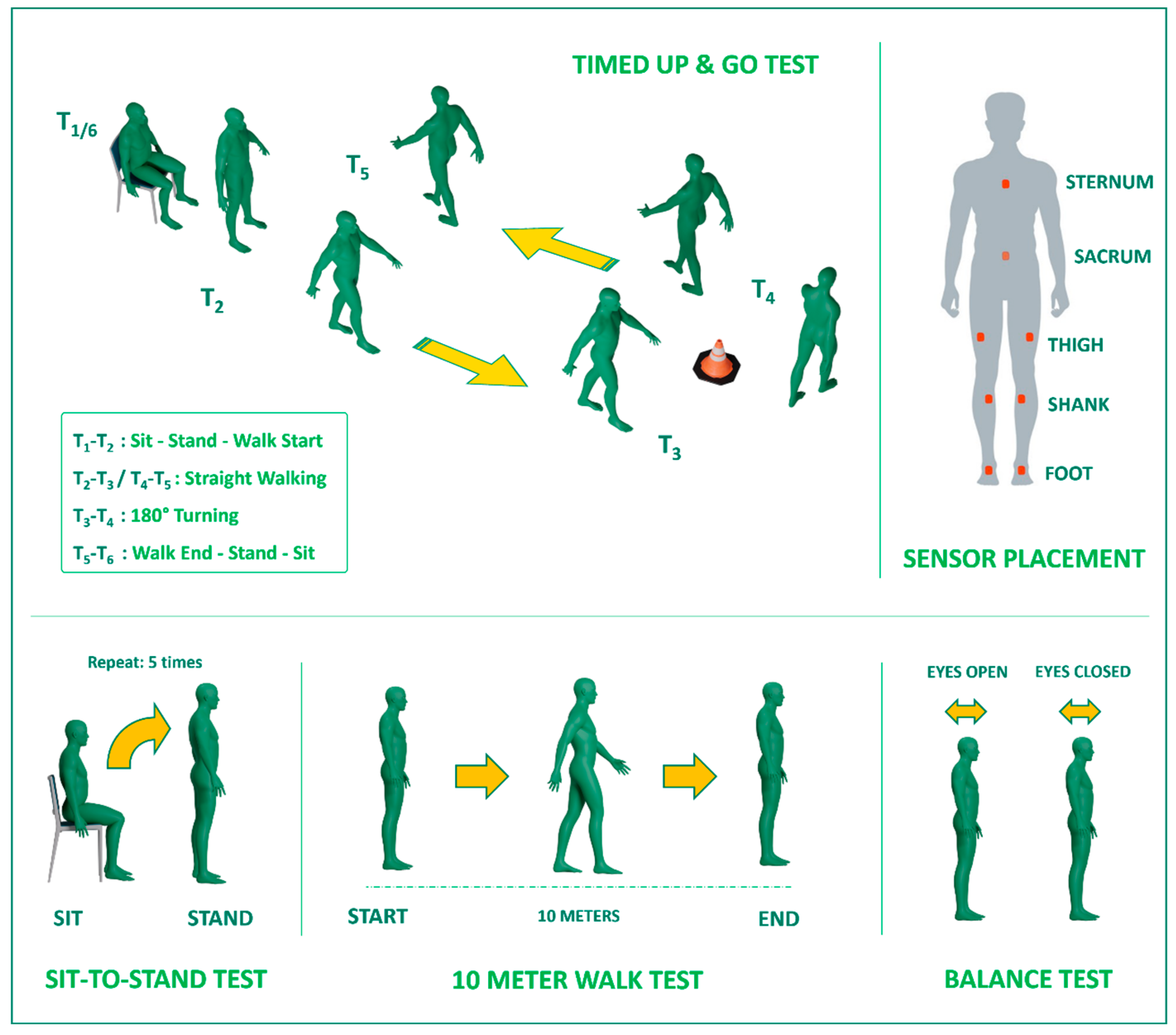 Fall Risk Assessment In Stroke Survivors A Machine Learning Model Fall Risk Assessment In Stroke Survivors A Machine Learning Model