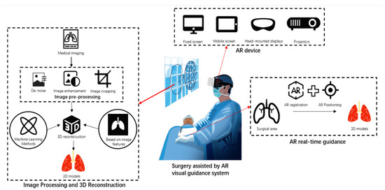 The Application of Augmented Reality Technology in Perioperative Visual ...