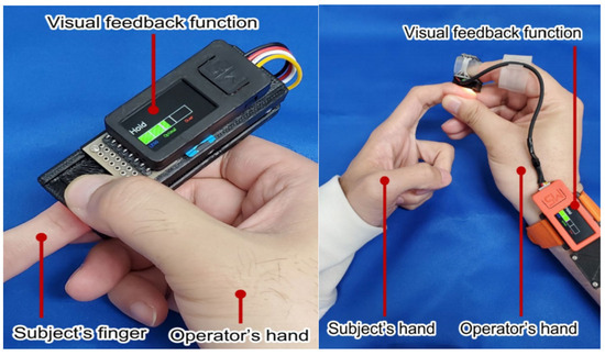 Research Progress on the Measurement Methods and Clinical Significance ...