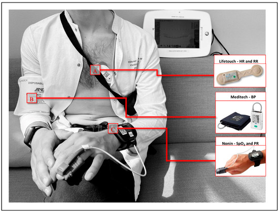 Continuous Wireless Vital Sign Sensors for Detecting Severe Deviations ...