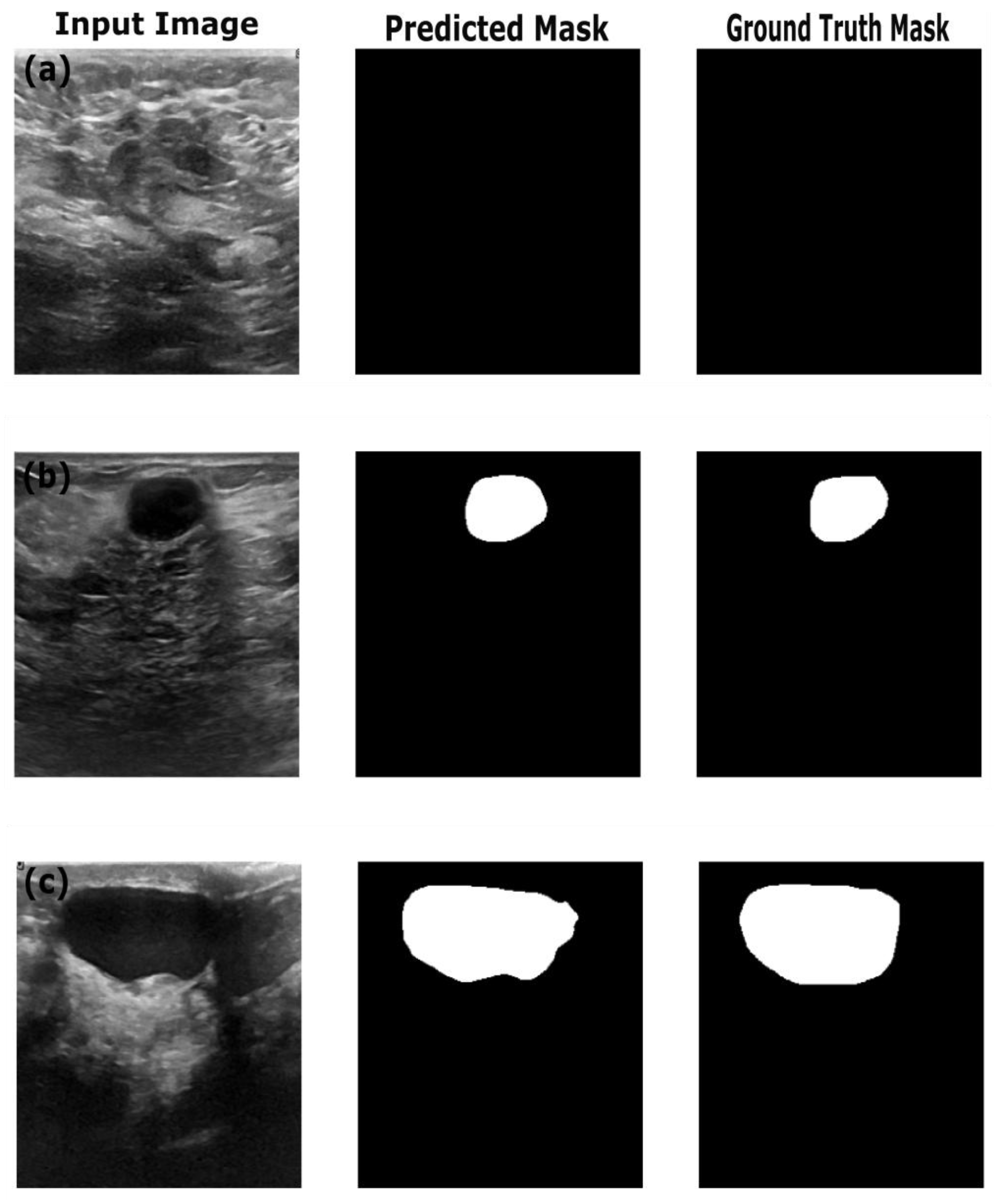 Deep Learning for Tumor Segmentation and Multiclass Classification in Breast Ultrasound Images ...