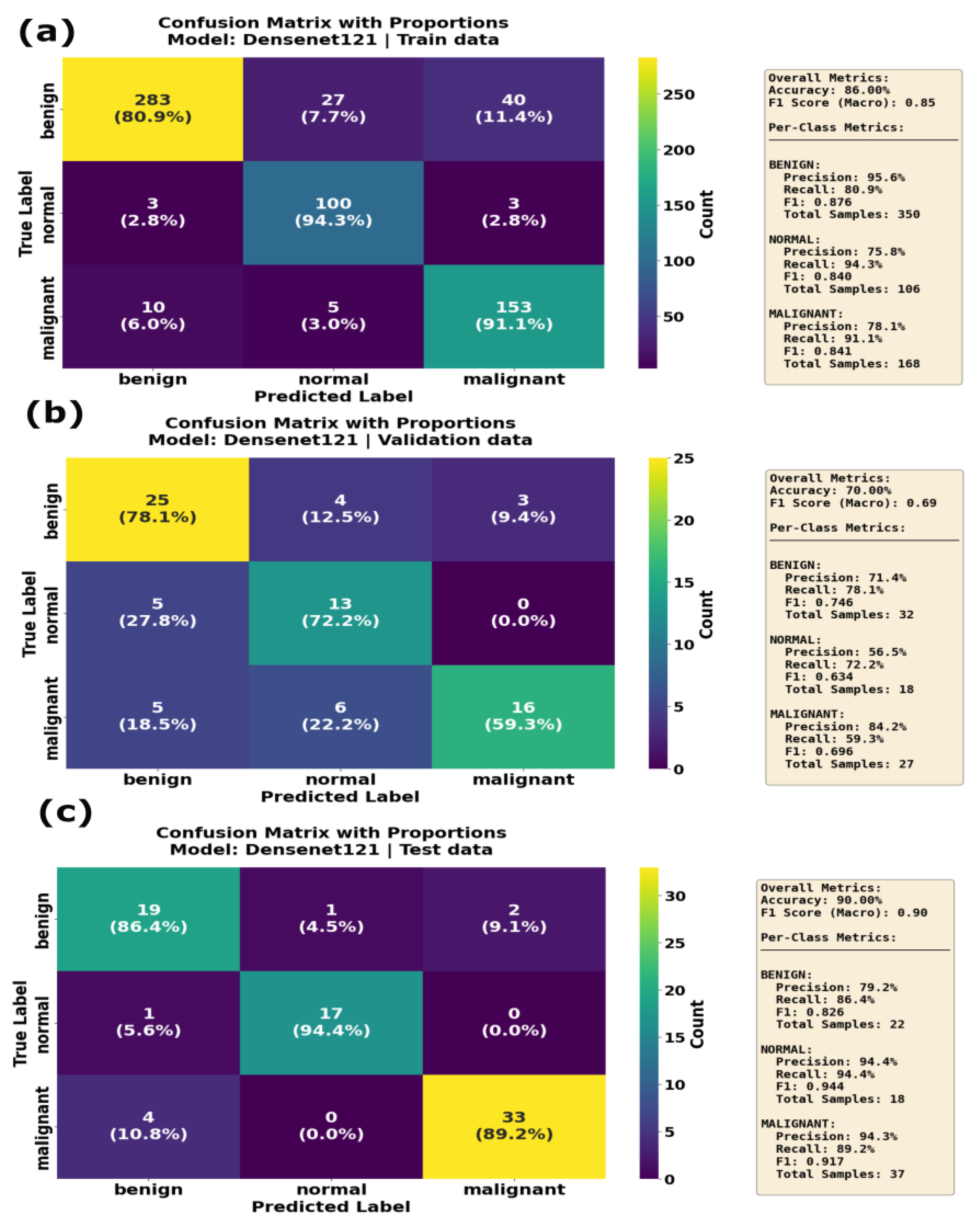 Deep Learning for Tumor Segmentation and Multiclass Classification in Breast Ultrasound Images ...