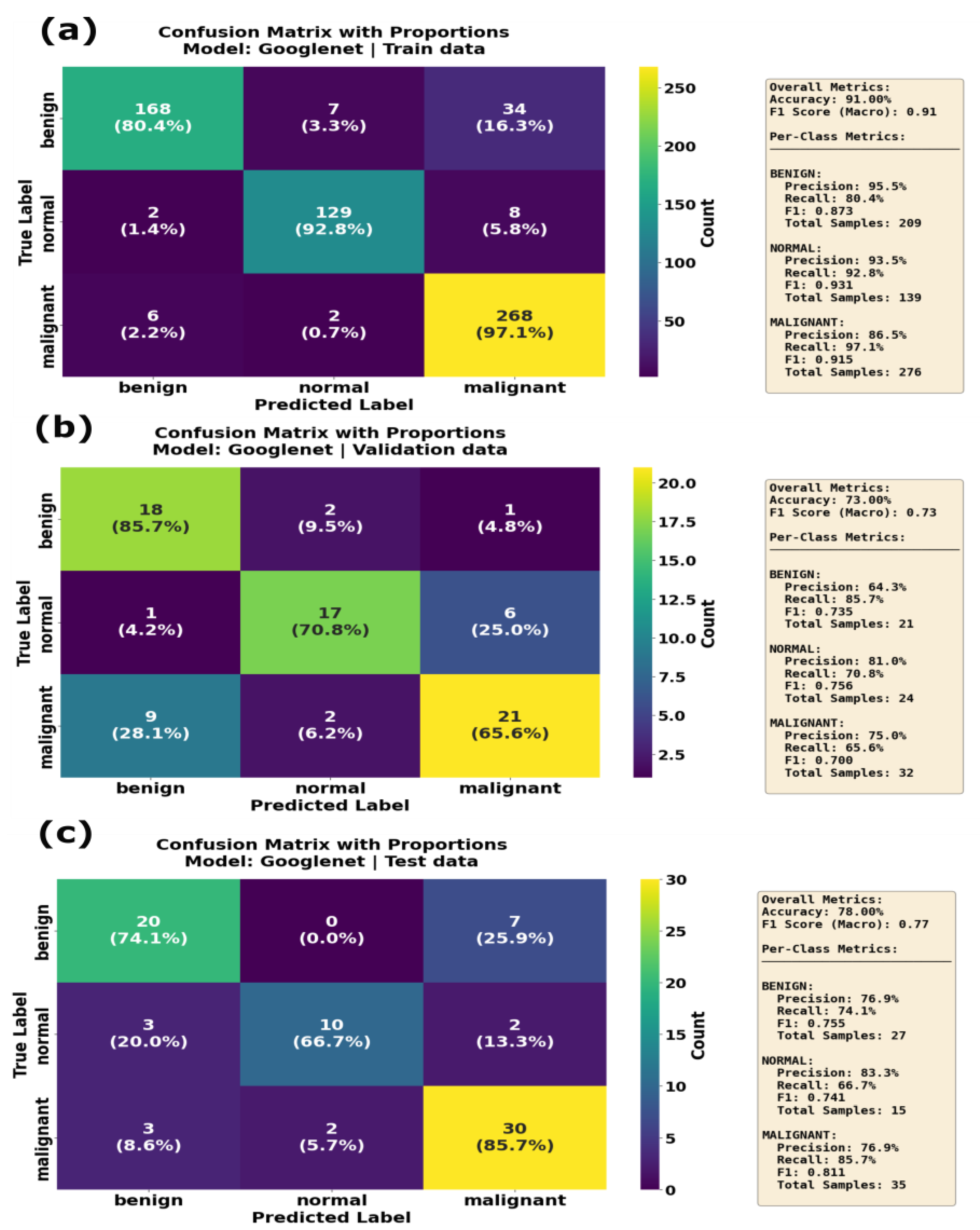 Deep Learning for Tumor Segmentation and Multiclass Classification in Breast Ultrasound Images ...