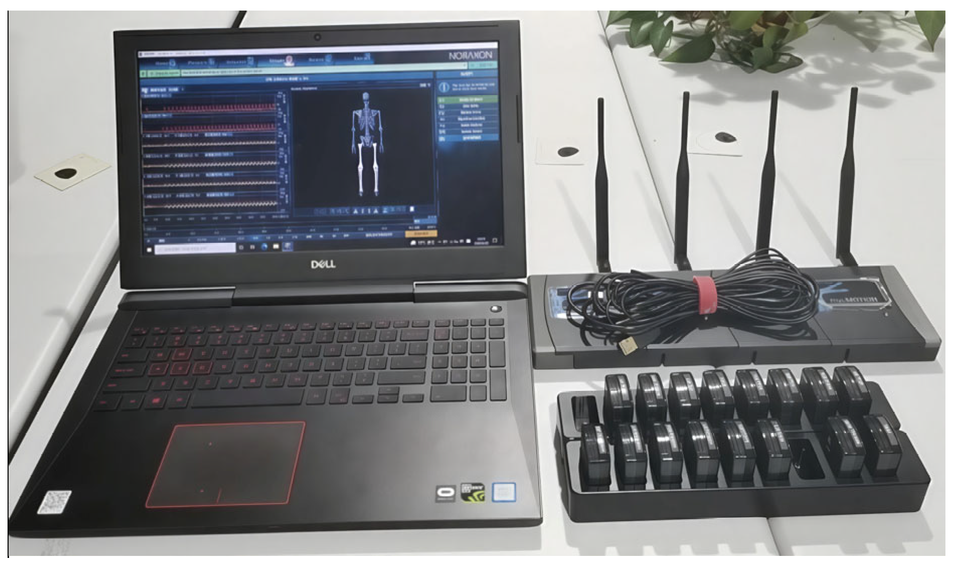 A Pilot Study on Motion Intention Mapping and Direct Myoelectric ...