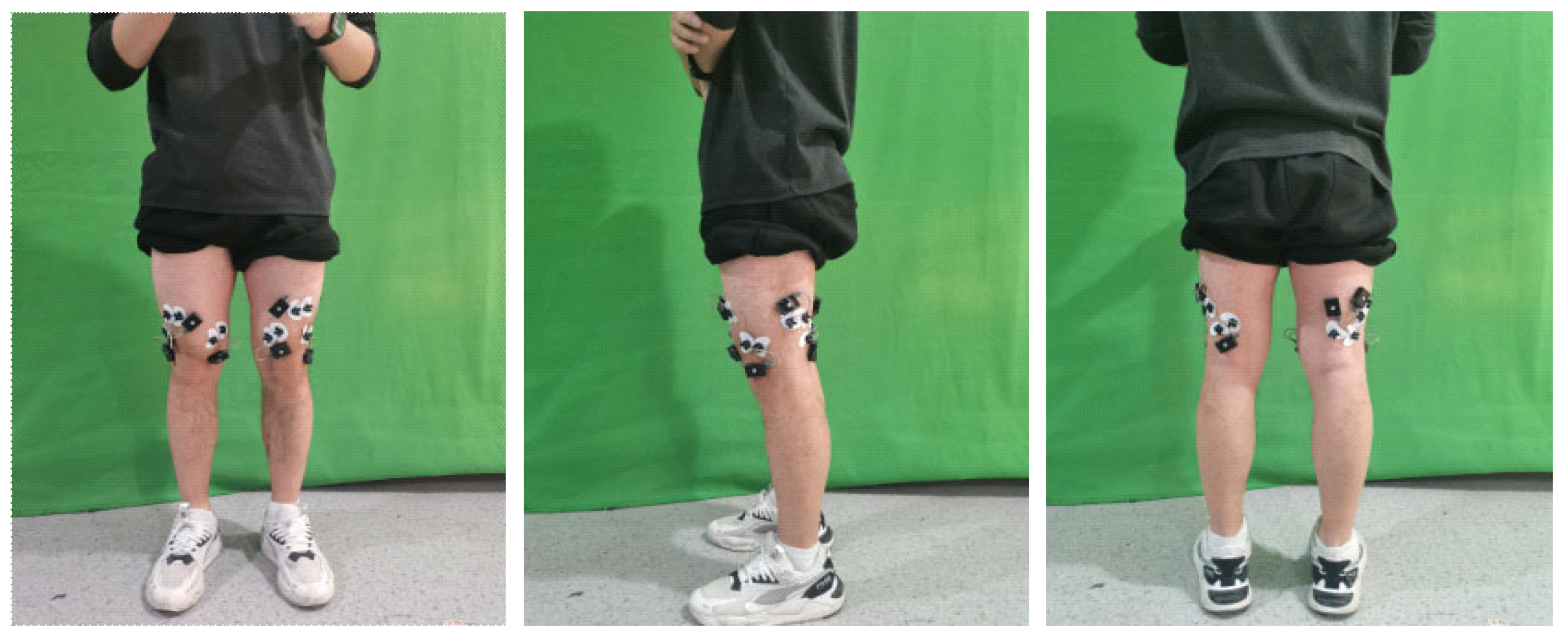 A Pilot Study on Motion Intention Mapping and Direct Myoelectric ...
