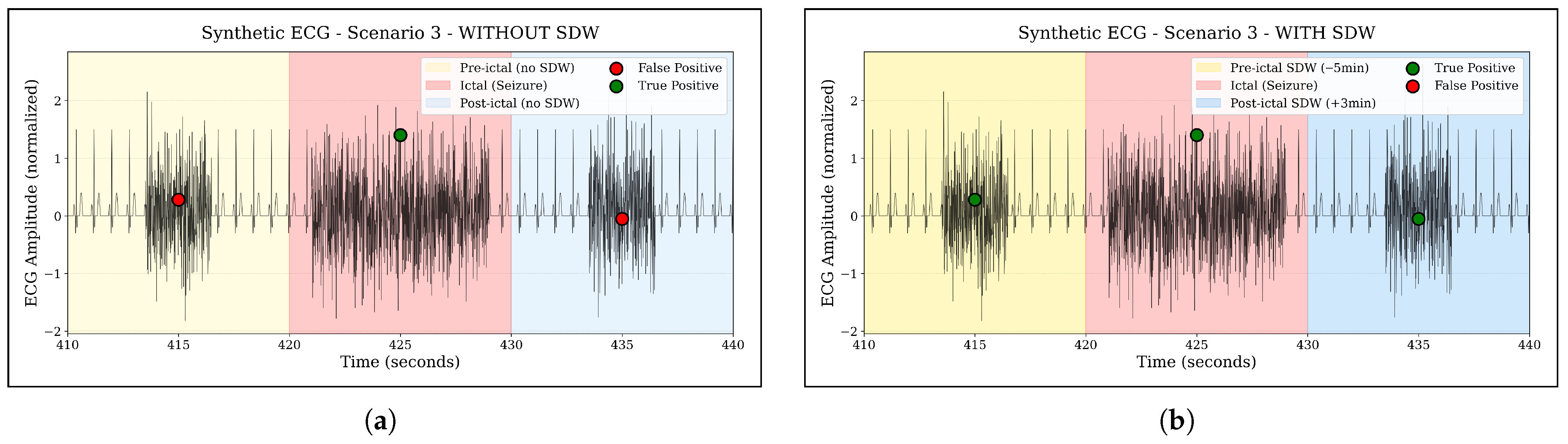 ECG-Based Detection of Epileptic Seizures in Real-World Wearable ...