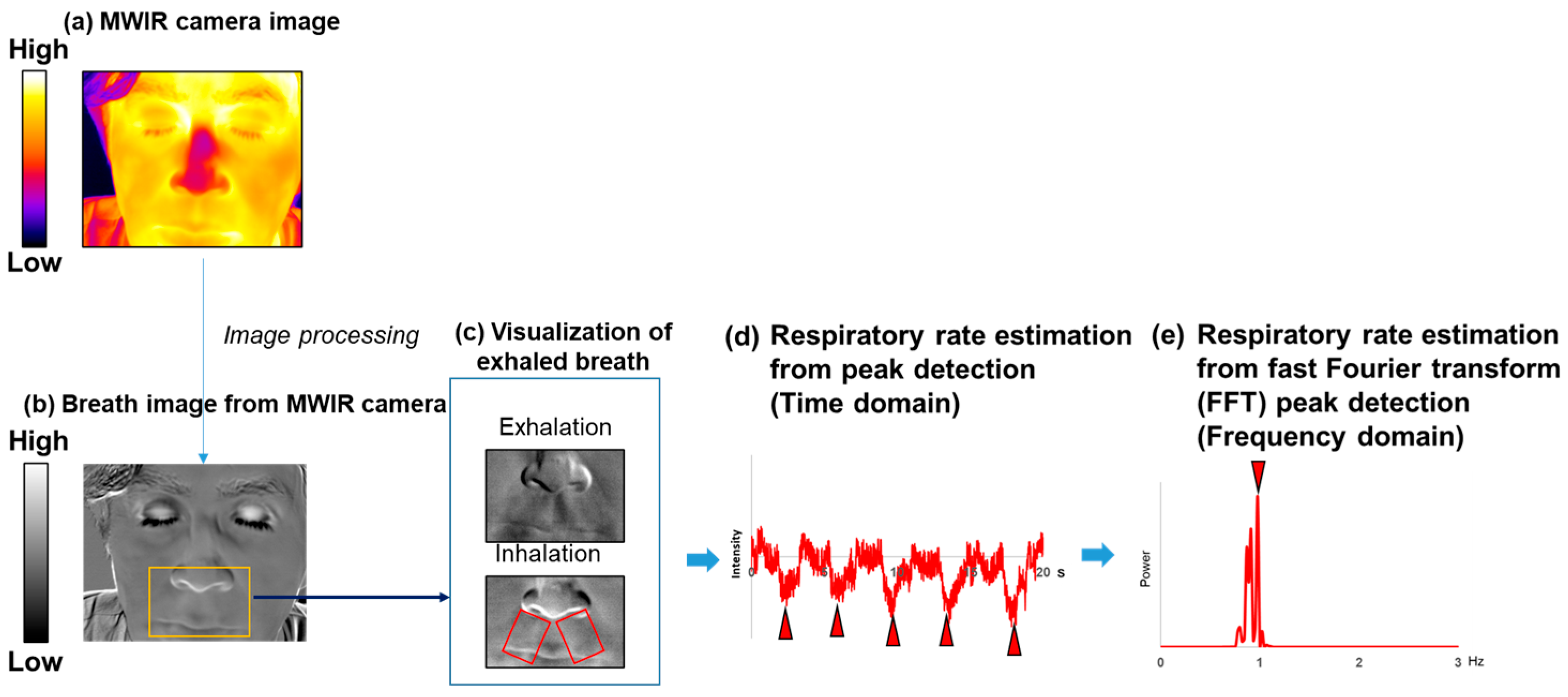 Noncontact Visualization of Respiration and Vital Sign Monitoring Using ...