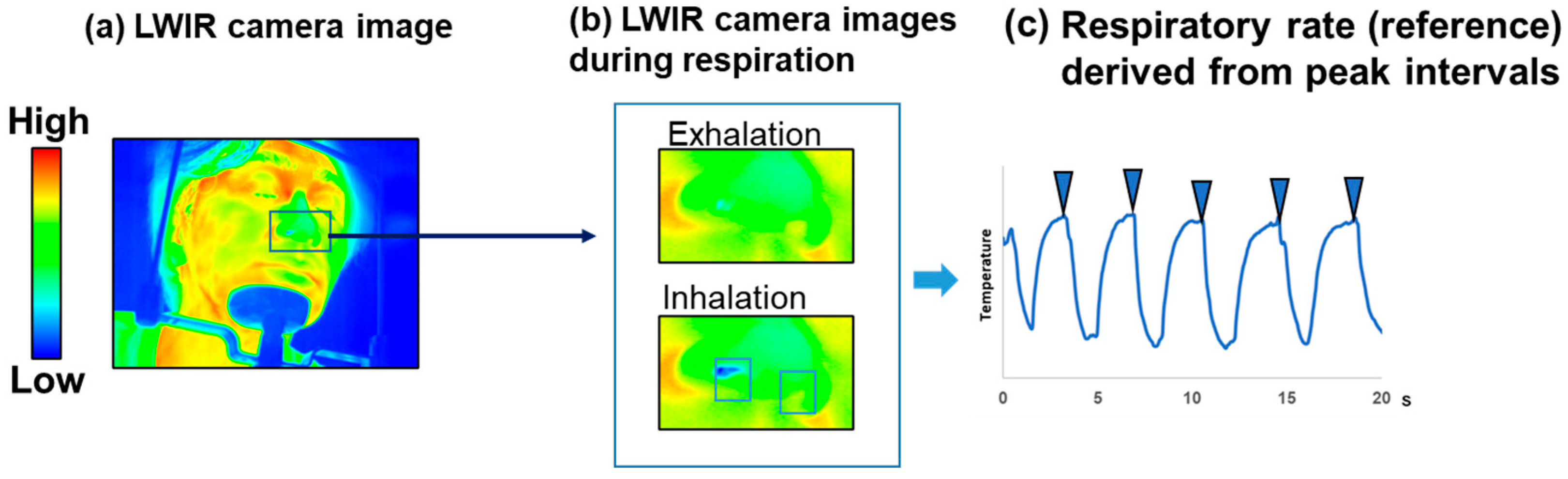 Noncontact Visualization of Respiration and Vital Sign Monitoring Using ...